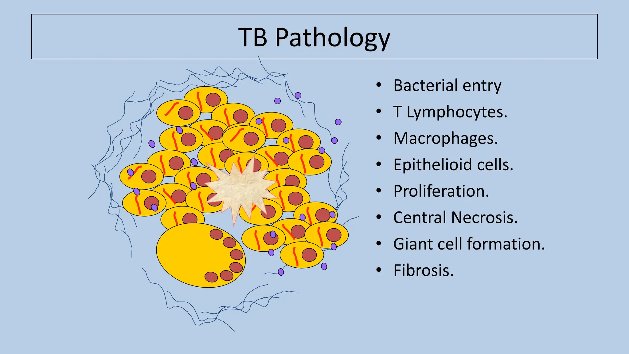 Tuberculosis pathophysiology and diagnosis | Jindal Chest Clinic | PPTX