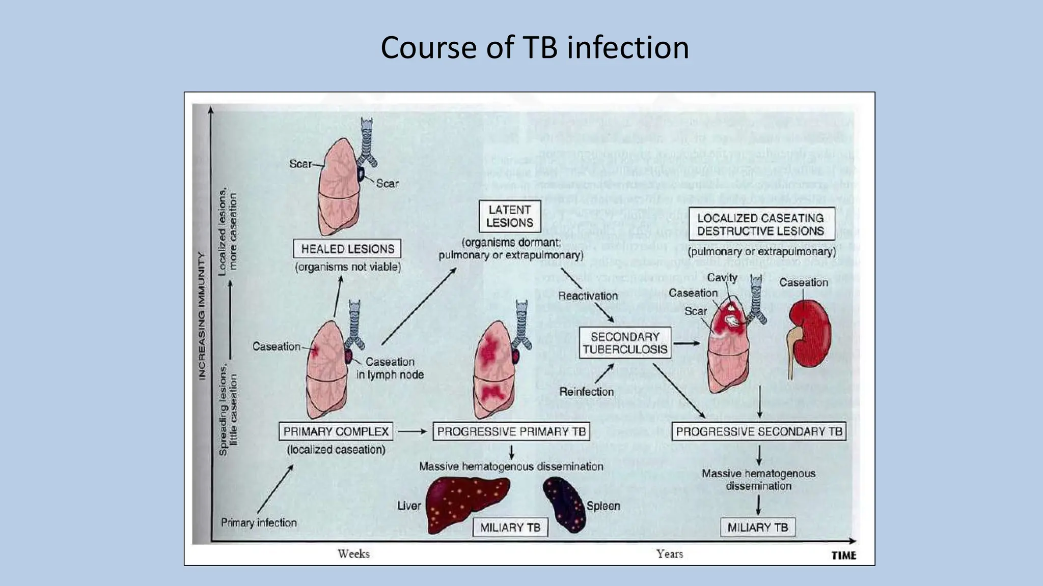 Tuberculosis pathophysiology and diagnosis | Jindal Chest Clinic | PPTX