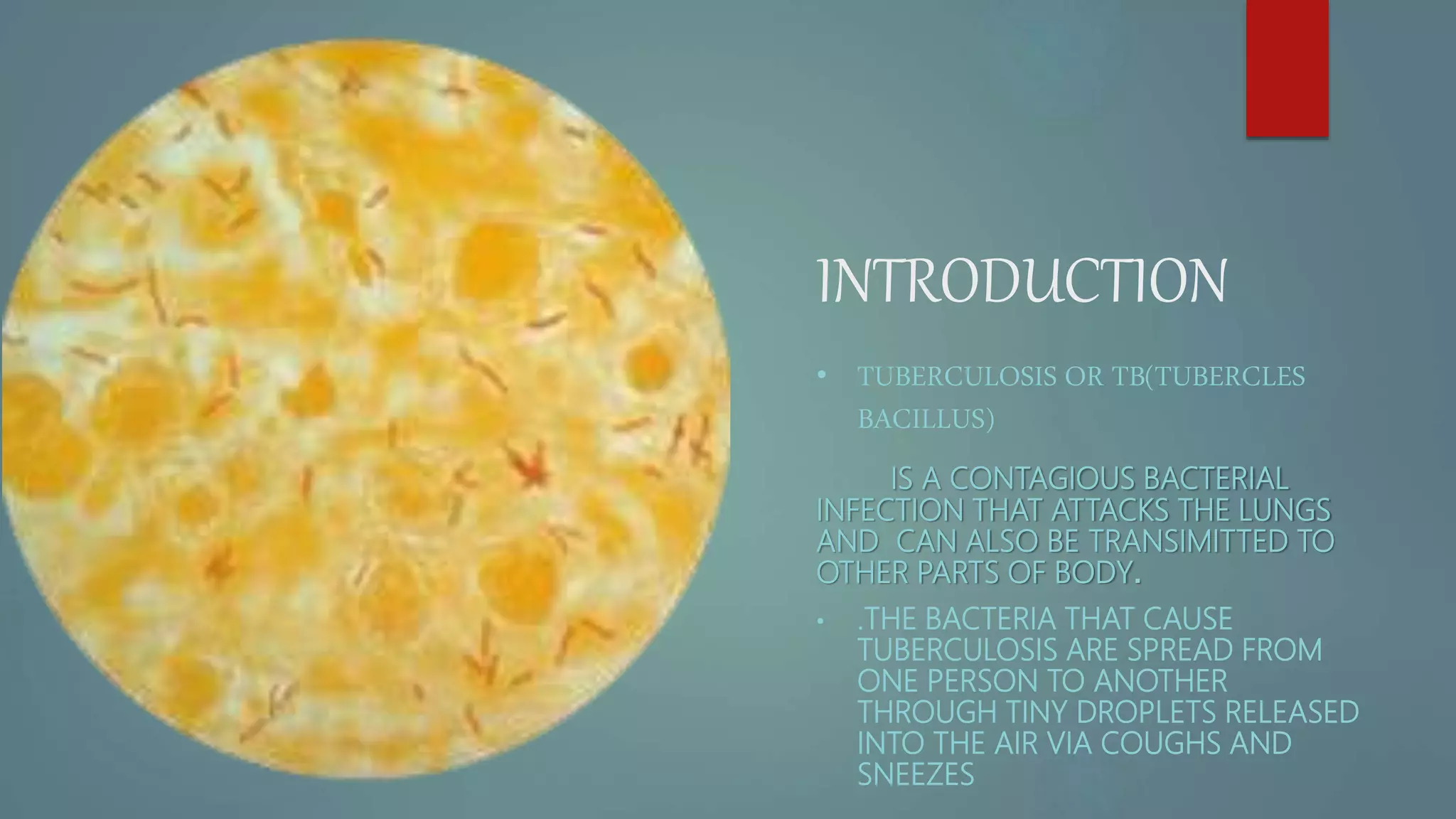 Tuberculosis ppt | PPT