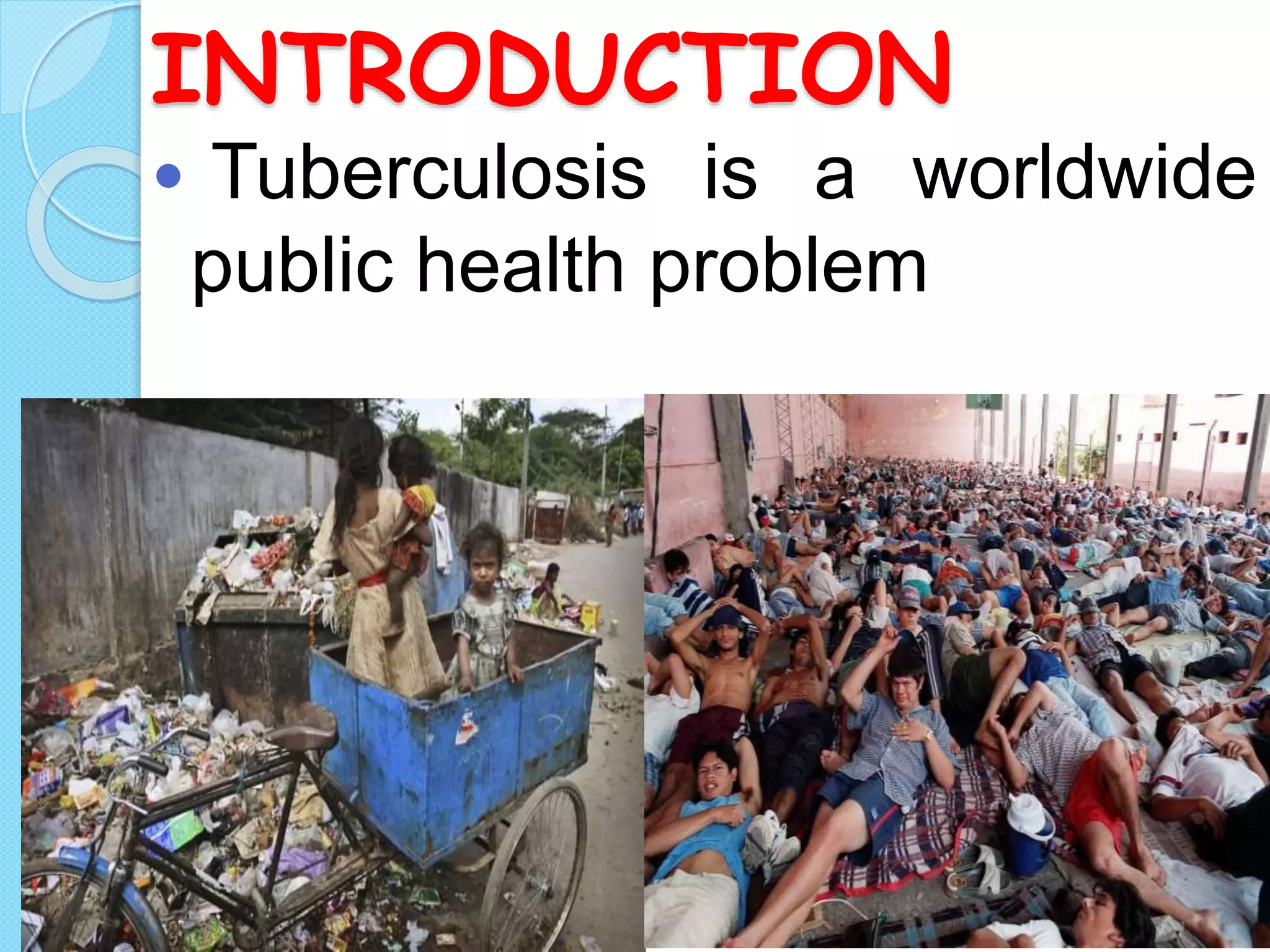 Tuberculosis ppt | PPTX