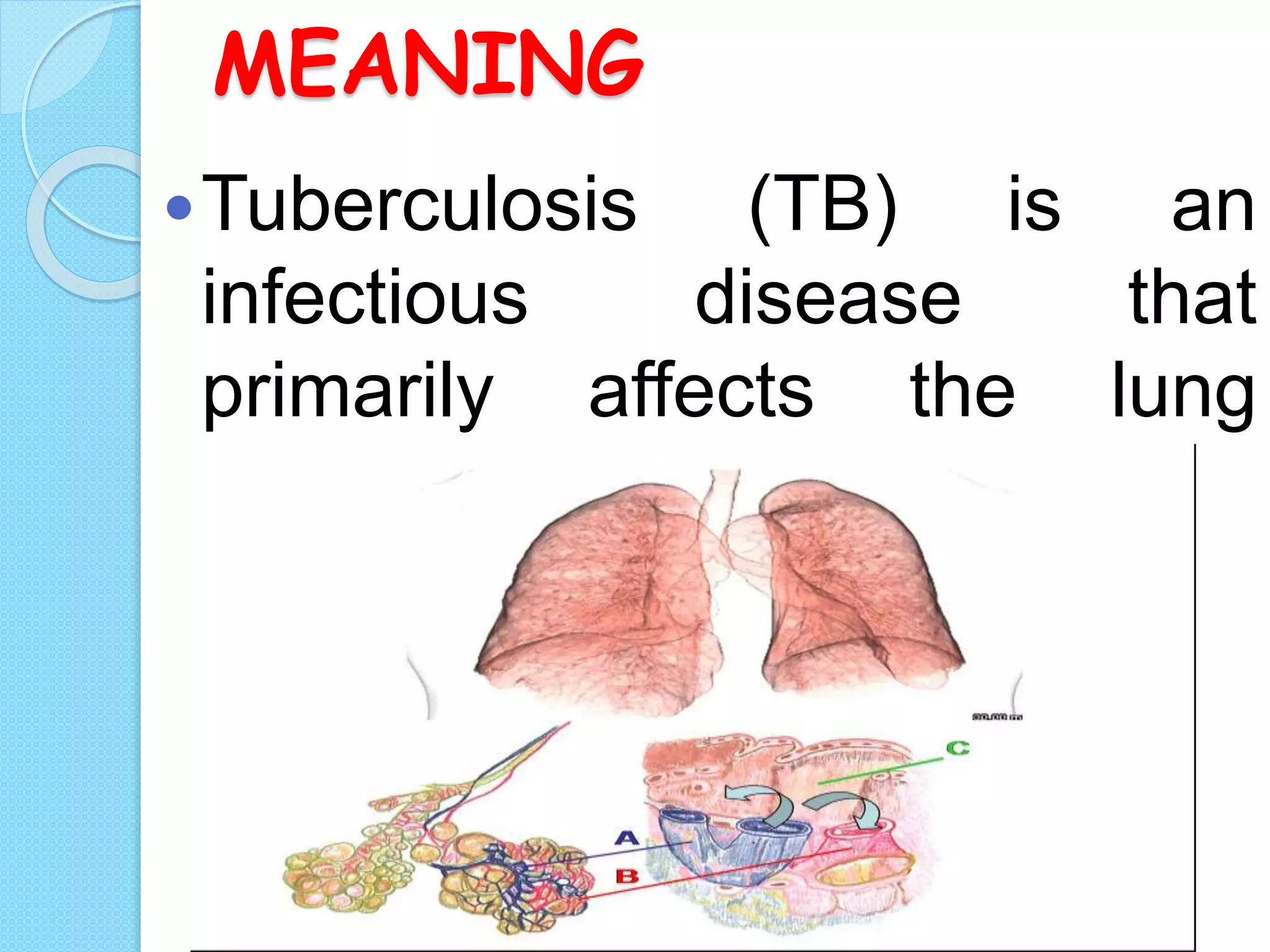 Tuberculosis ppt | PPTX