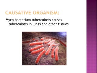 Tuberculosis | PPTX | Lung and Respiratory Health | Diseases and Conditions