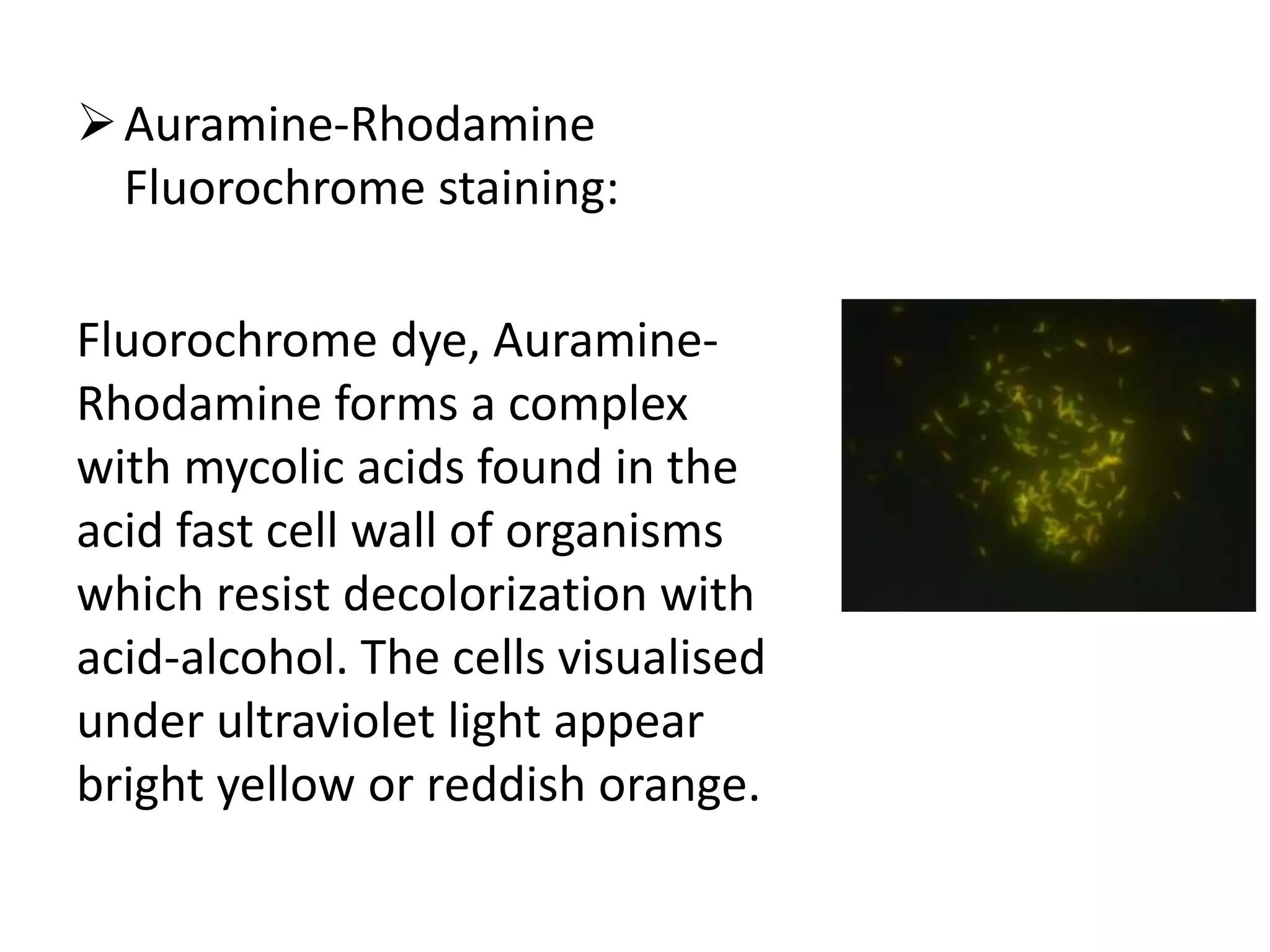 Tuberculosis ppt | PPTX