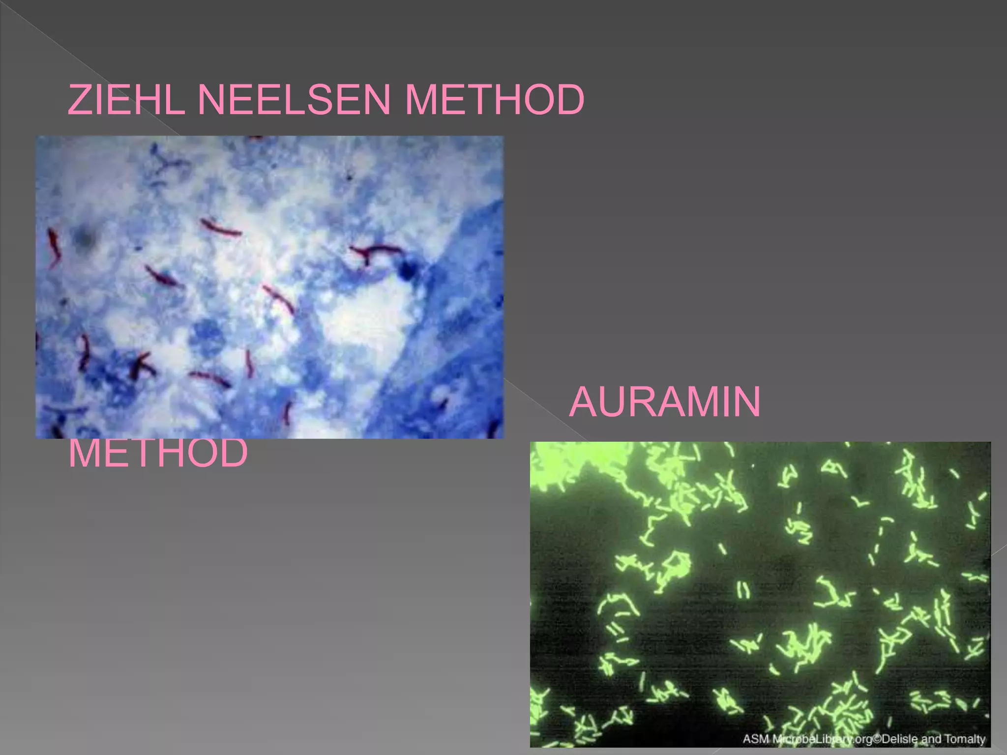 Tuberculosis | PPTX