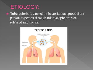 Tuberculosis | PPTX
