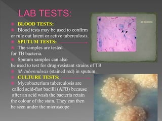 Tuberculosis | PPTX