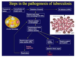 Tuberculosis presentation with introduction of its bacteria | PPTX ...