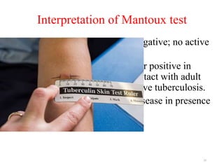 Tuberculosis presentation with introduction of its bacteria | PPTX ...
