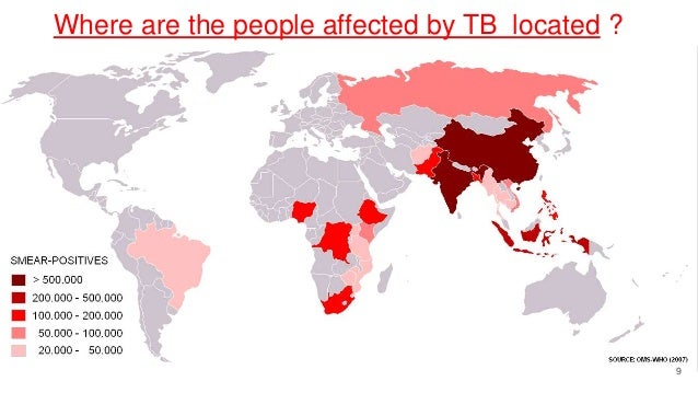 Tuberculosis (TB) - Public Health Presentation