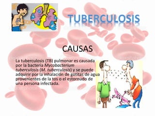Tuberculosis pulmonar | PDF