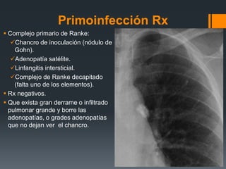 Actualizacion de la Tuberculosis pulmonar diagnóstico Imagenológico | PPTX