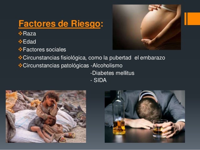 Actualizacion de la Tuberculosis pulmonar diagnóstico Imagenológico