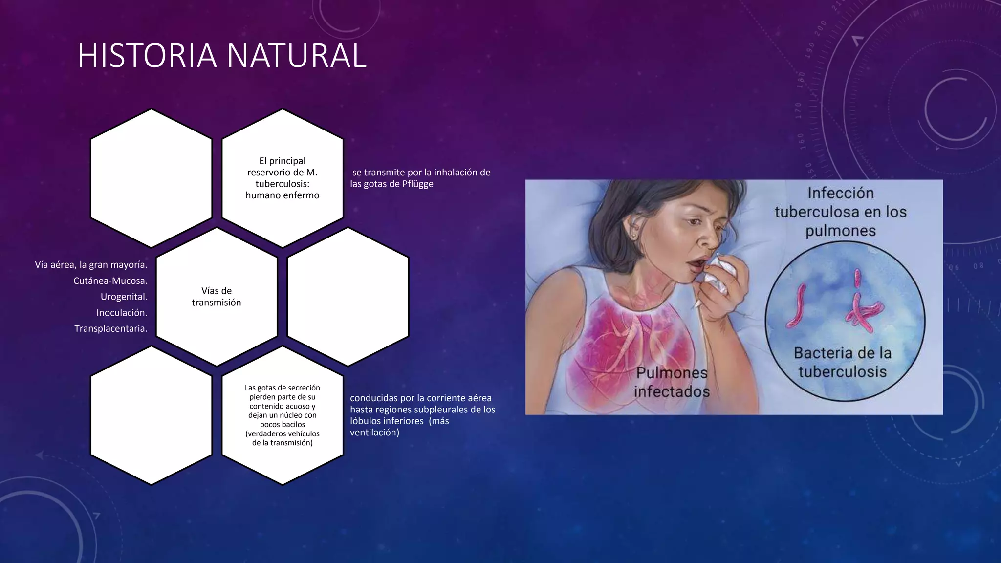 Tuberculosis pulmonar | PPTX