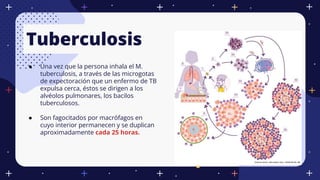 tuberculosis pulmonar.pdf