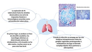 tuberculosis en pediatria generalizades .pptx