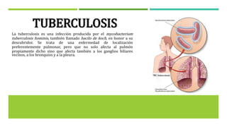 TUBERCULOSIS | PPTX