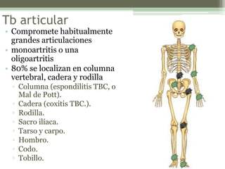 Tuberculosis ósteoarticular | PPTX