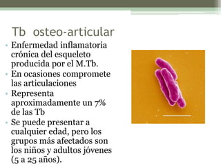 Tuberculosis ósteoarticular | PPTX