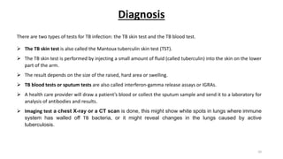 Tuberculosis (tb) | PPT