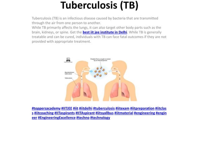 Tuberculosis (TB).pptx | Lung and Respiratory Health | Diseases and Conditions