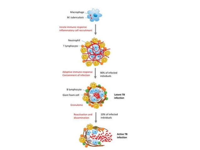 Tuberculosis (TB)-Notes.pdf microbiology notes | PDF | Lung and ...