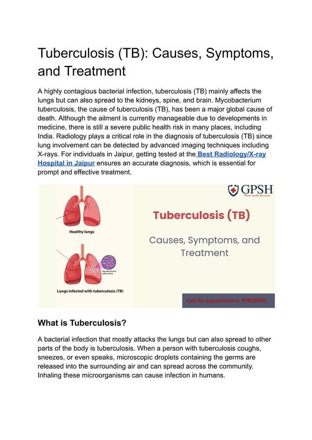 Tuberculosis (TB)_ Causes, Symptoms, and Treatment.pdf