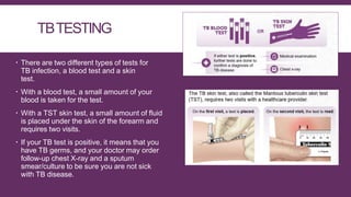Tuberculosis (T. B) Presentation . pptx | PPT