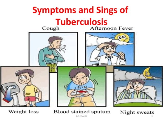 Tuberculosis Teaching Basics | PPT