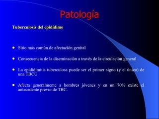 Tuberculosis urinaria | PPT