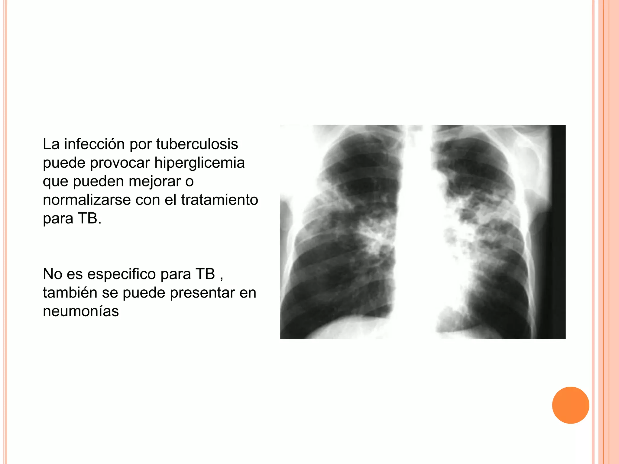 Tuberculosis y diabetes mellitus | PDF