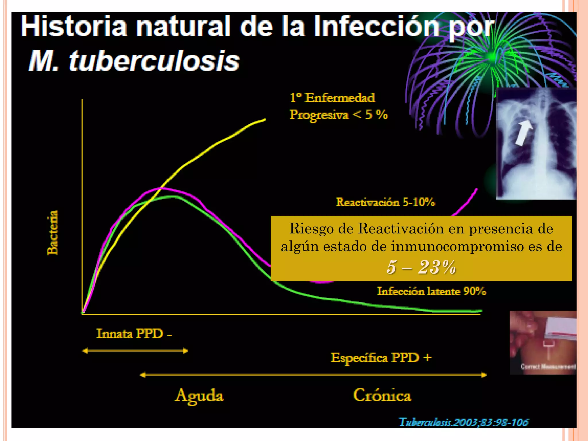 Tuberculosis y diabetes mellitus | PDF