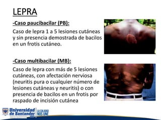 TUBERCULOSIS Y LEPRA.pptx