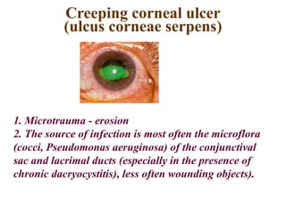Tuberculous and syphilitic keratitis.pptx