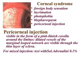 Tuberculous and syphilitic keratitis.pptx