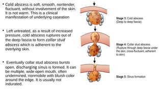 Tuberculous cervical lymphadinitis | PPT | Ear, Nose and Throat ...
