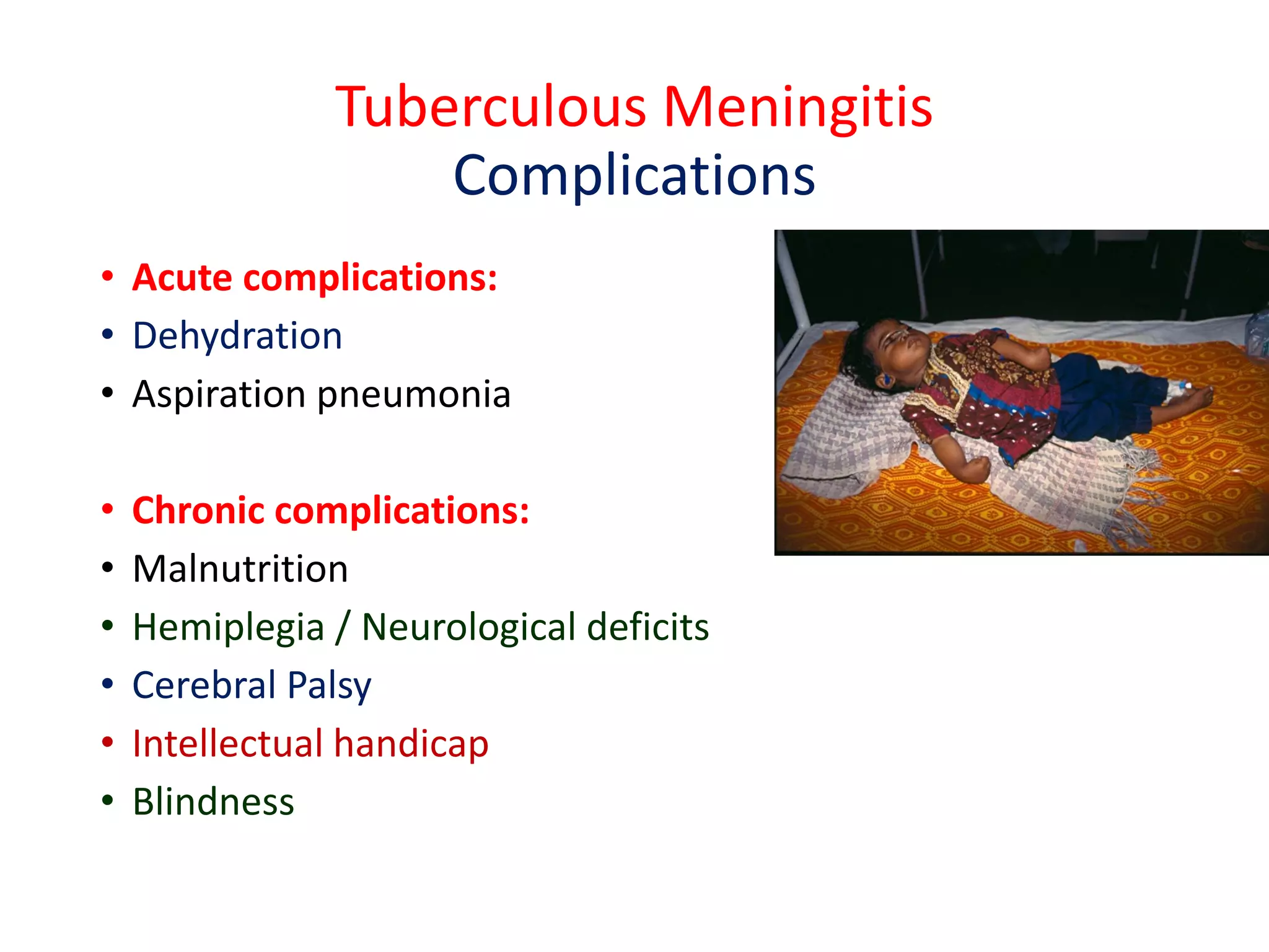 Tuberculous meningitis in children 2021 | PDF