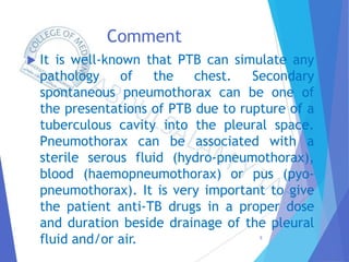 Tuberculous Pneumothorax.pdf