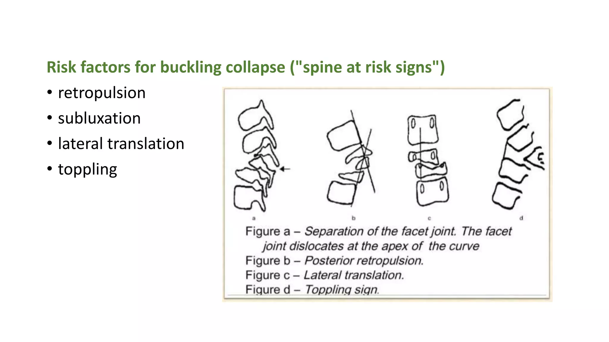Tuberculous spondylodiscitis.pptx