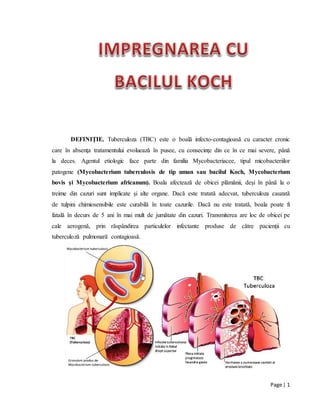 Tuberculoza | PDF