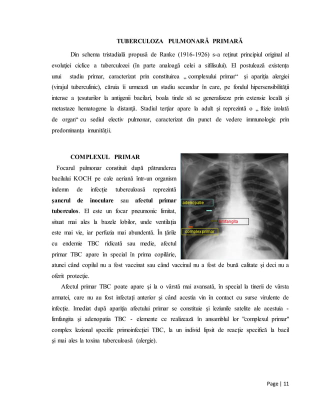 Tuberculoza | PDF