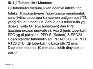 Tuberkulosis anak | PPT