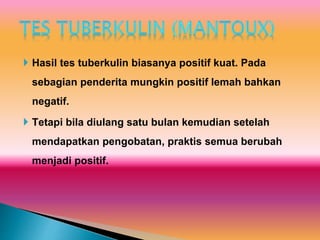 Tuberkulosis milier (milliary tb) dosen pkk ibu sri | PPTX
