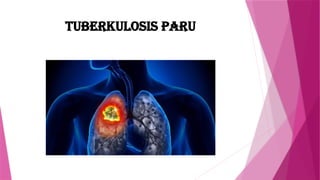 PENCEGAHAN DAN PENGOBATAN TUBERKULOSIS PARU.pptx
