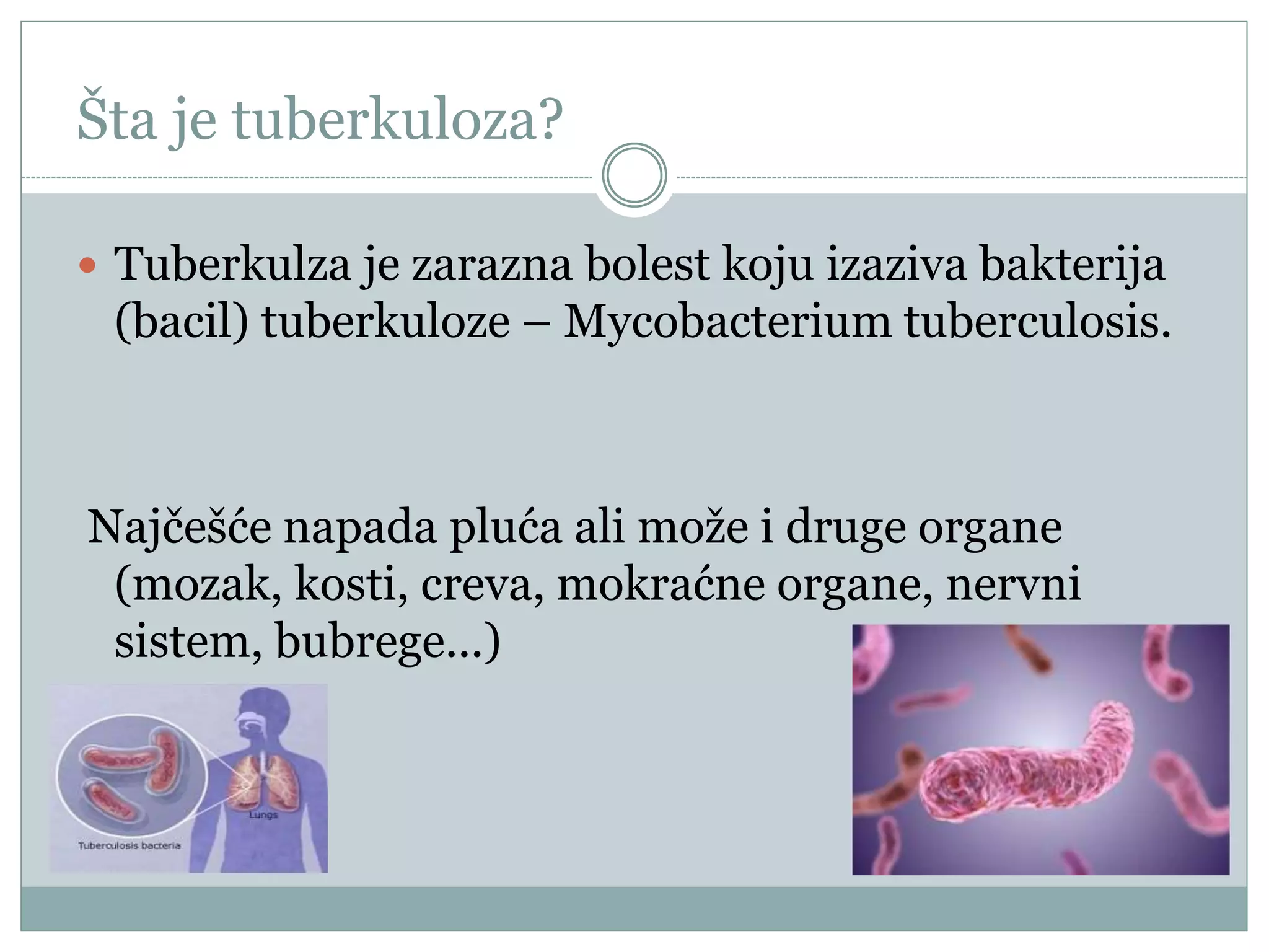 Tuberkuloza uradila Aleksandra Macura | PPTX