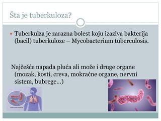 Tuberkuloza uradila Aleksandra Macura | PPTX
