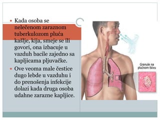 Tuberkuloza uradila Aleksandra Macura | PPTX