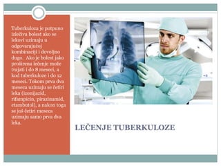 Tuberkuloza uradila Aleksandra Macura | PPTX