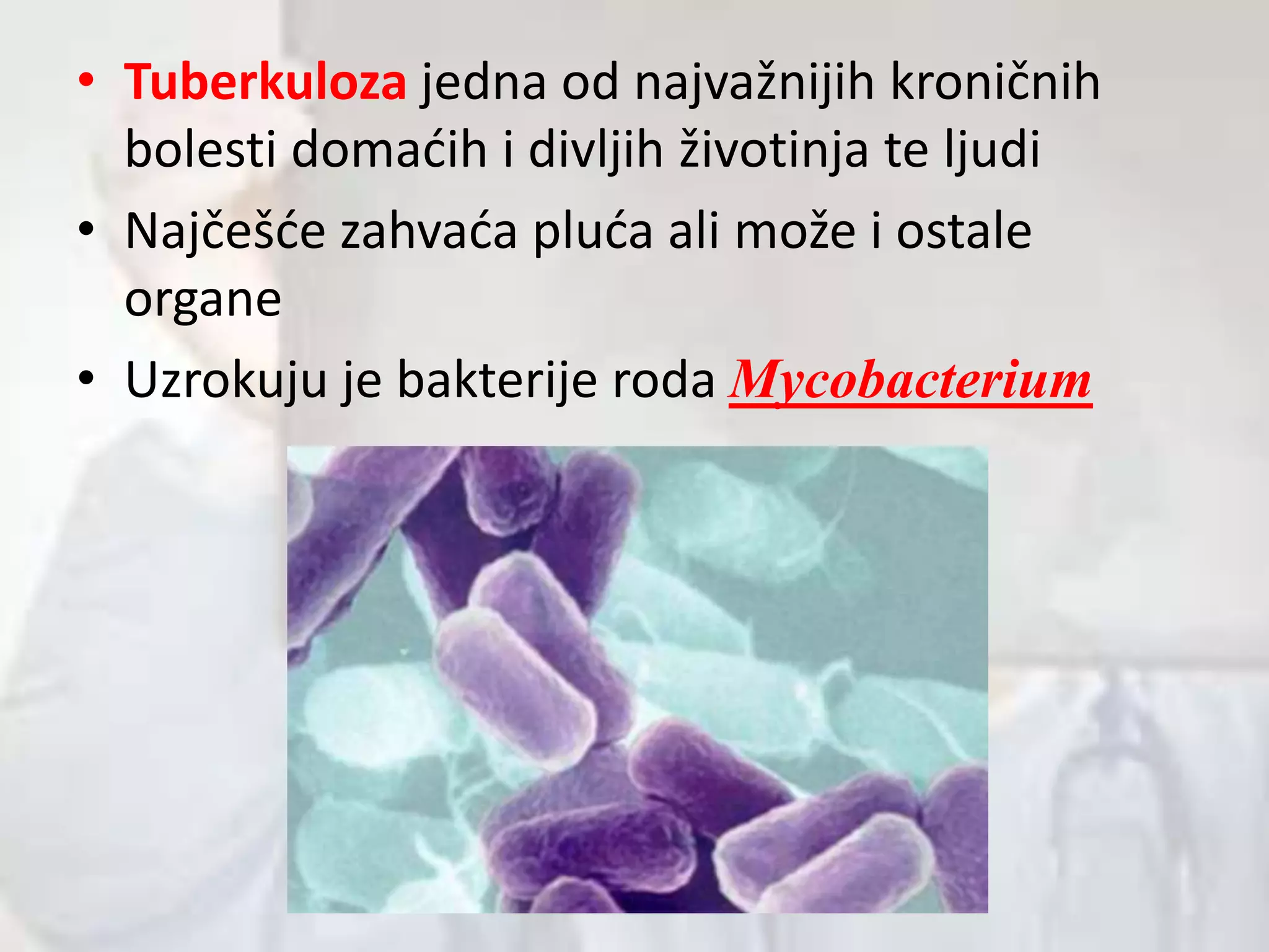 Tuberkuloza-Tuberculosis | PPTX