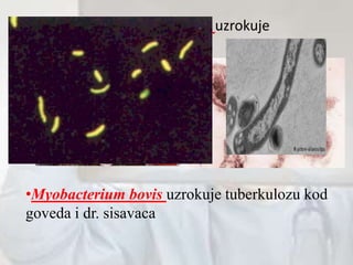Tuberkuloza-Tuberculosis | PPTX