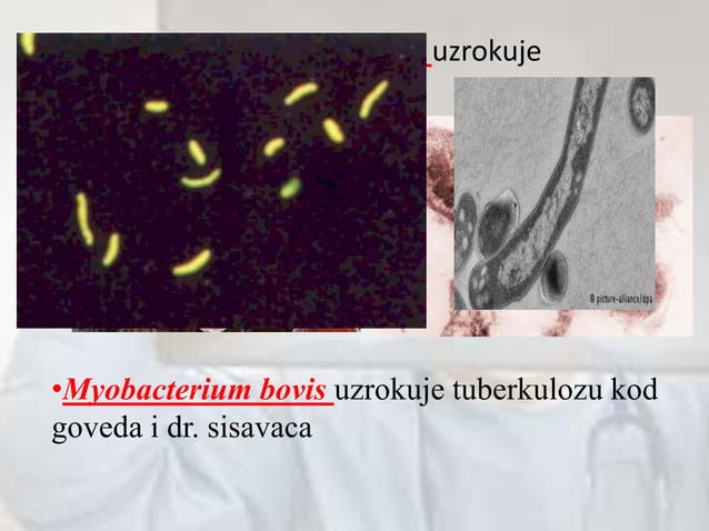 Tuberkuloza-Tuberculosis | PPTX